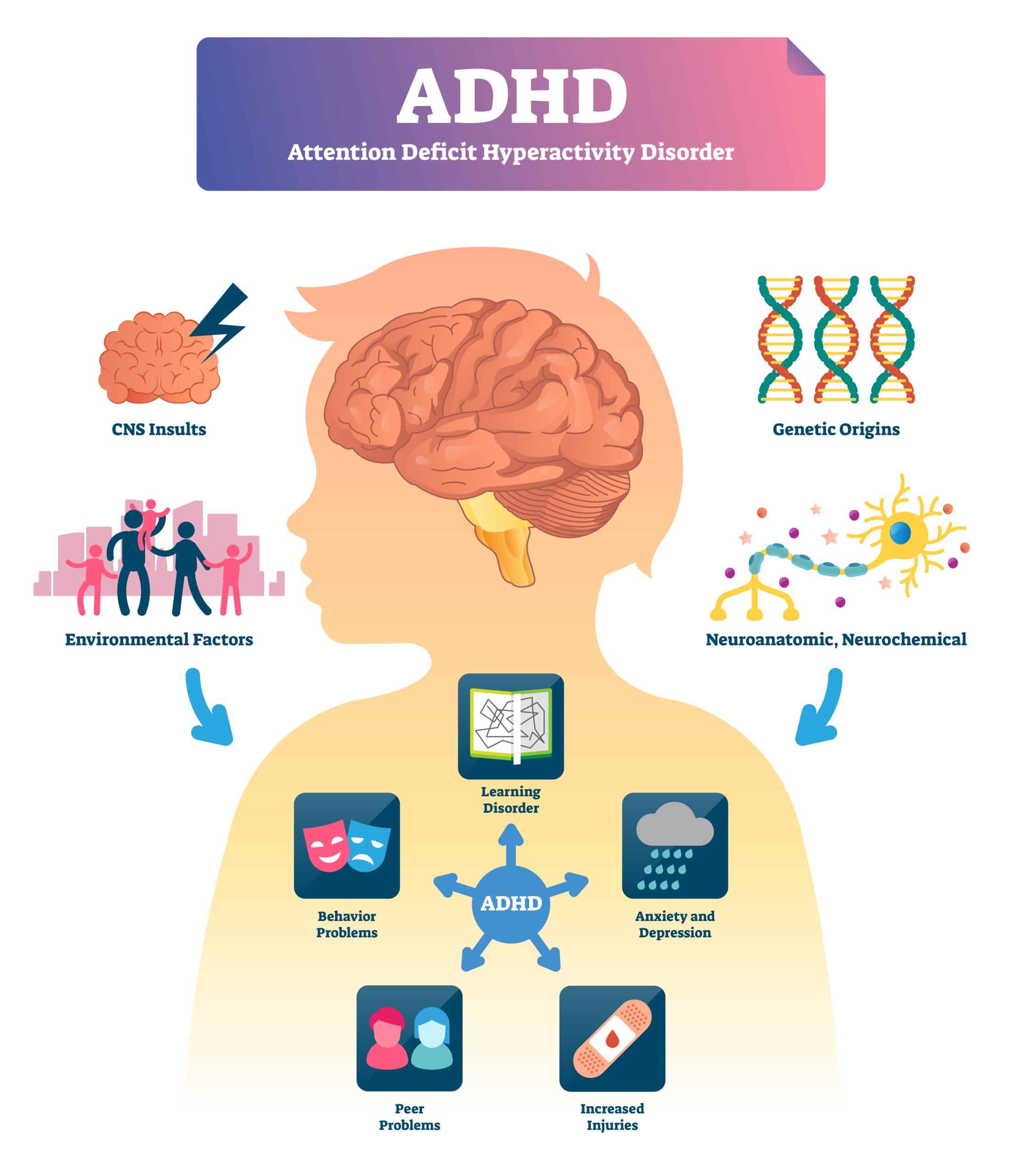 Adhd Vector Illustration Labeled Attention Deficit Hyperactivity