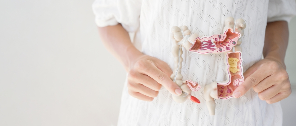 Root Cause Analysis in Functional Medicine Practice